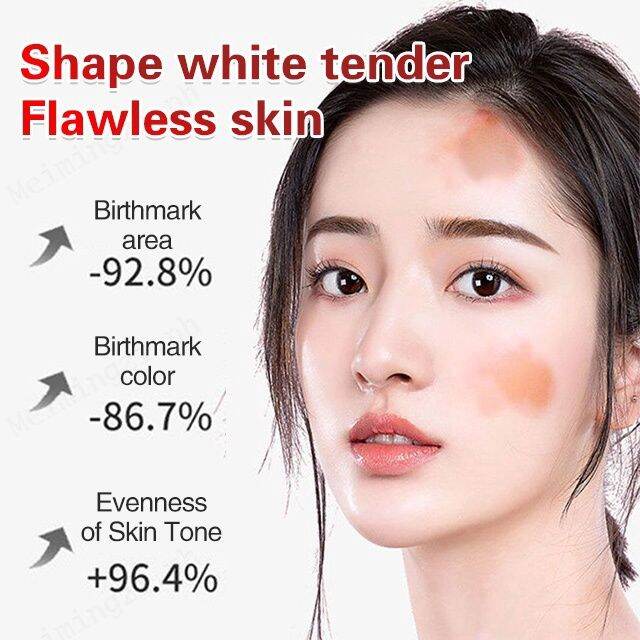 Meimingzi Herbalmate Birthmark Removal Essential Oil | Lazada PH