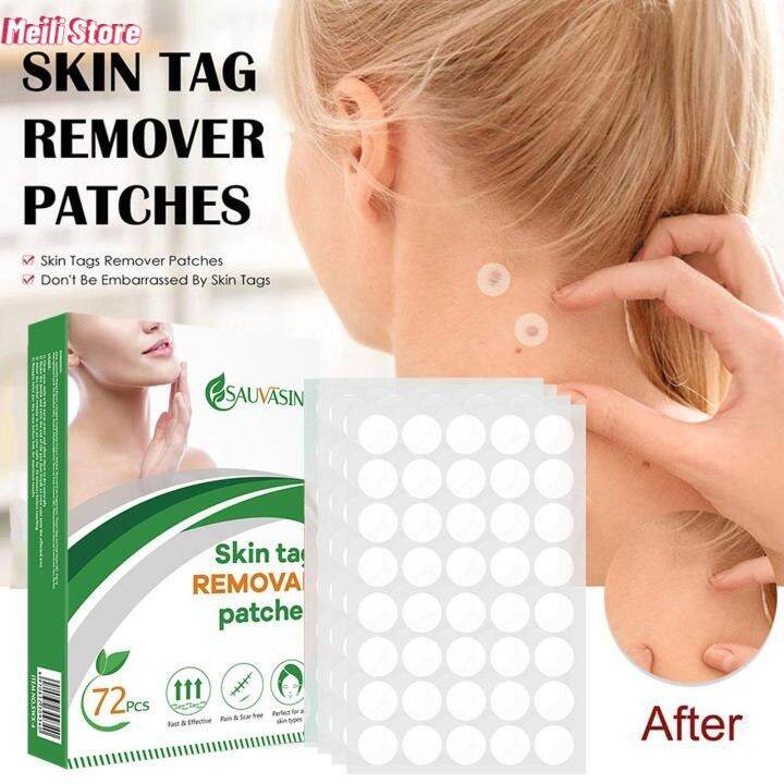 Meili Store SAUVASINE Skin Tag Remover Patch 2 Sheets Acne Removal ...