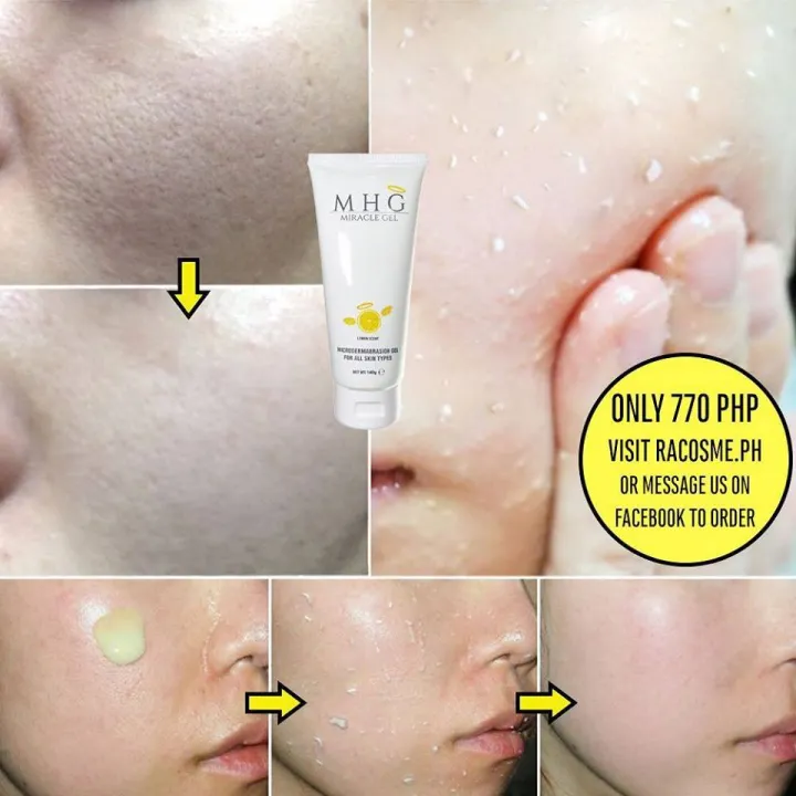 【new】 BUY 1 TAKE 1 MHG Miracle Gel Scrub | Lazada PH