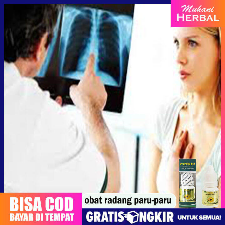 PROPOLIS SM Obat Untuk Penyakit Radang Paru Paru Basah Pneumonia Efusi ...
