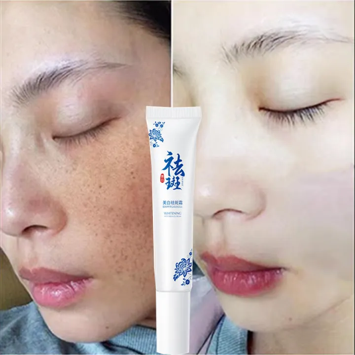Dark Spot Corrector Cream Whitening Freckle Cream Powerful Removing Melasma Melanin Dark Spots ...