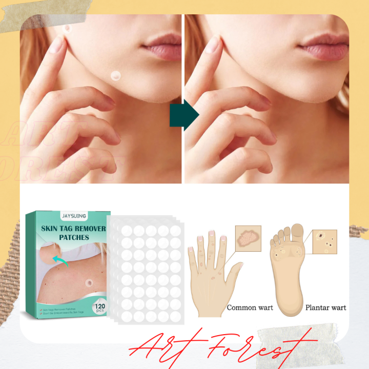 Skin Tag Remover Patch Wart Treatment Stickers Absorb Plaster ...