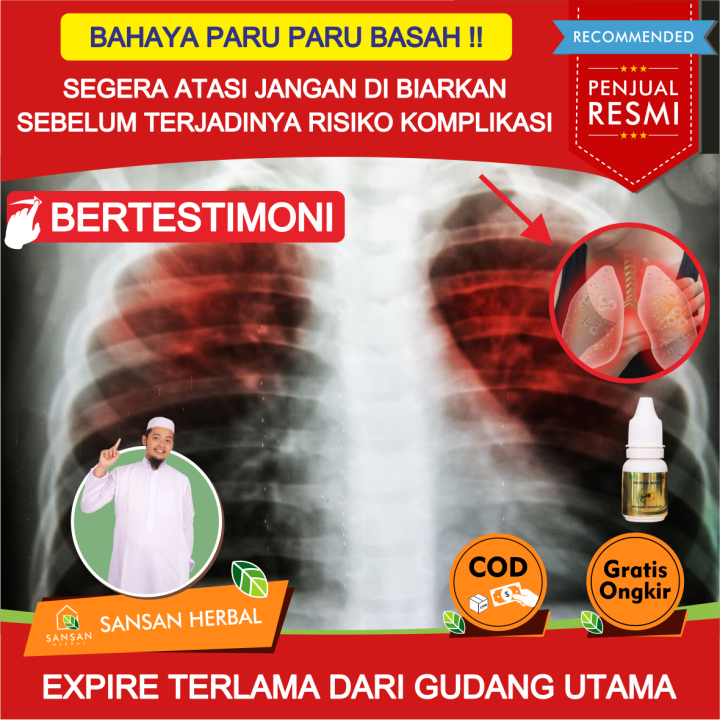 Obat Paru Paru Basah Di Apotik, Paru Paru Berair, Cairan Paru Paru ...