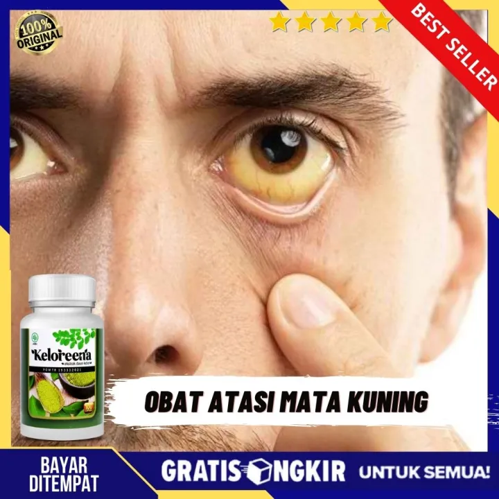 Obat Buat Mata Kuning Herbal - Obat Alami Pembersih Mata Kuning ...