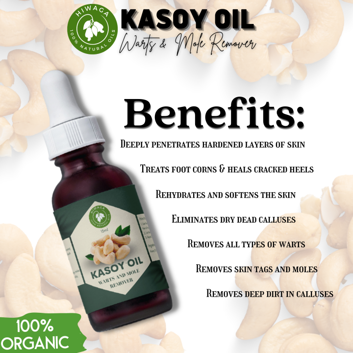 [HIWAGA]Organic & Natural Kasoy Oil(15ml) Safe & Effective in Warts ...