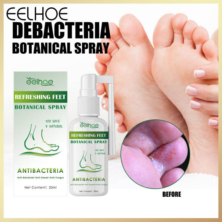 Eelhoe Refreshing Feet Spray Antibacterial Quick Relieve Itching ...