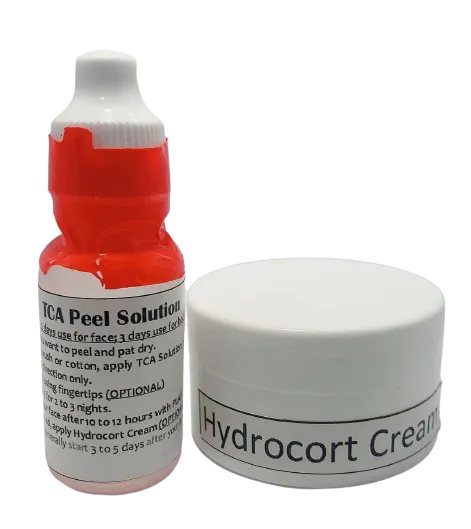 TCA Skin Peeling Solution 50% 20ml and hydrocort cream | Lazada PH