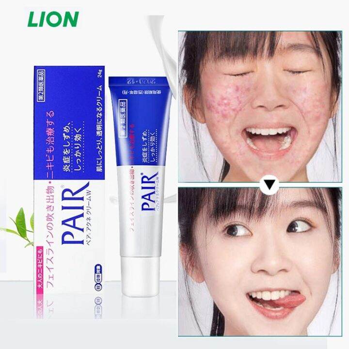 Japan Lion Pair Pimple Marks Remover Acne Remover Cream Face Acne ...