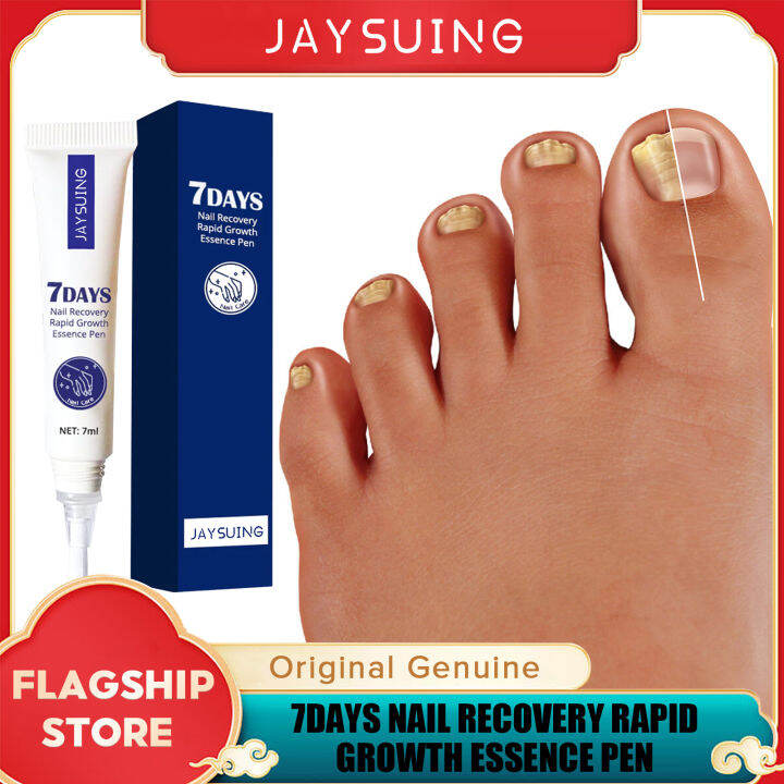 Jaysuing 7 Days Nail Recovery Rapid Growth Essence Pen Treatments Toe Nails Fungal Anti ...