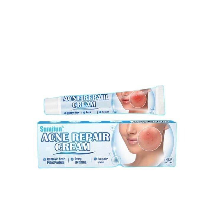 100% Original Acne Repair Cream 20g Fades Acne Marks Pimple Eraser Acne ...