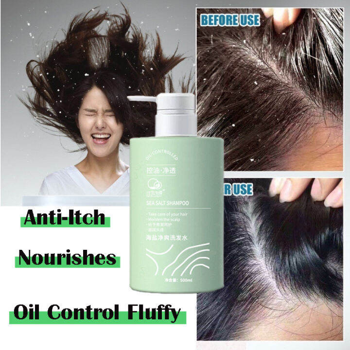 anti-dandruff shampoo, anti-itching and anti-mite shampoo amino acid sea salt shampoo refreshing ...