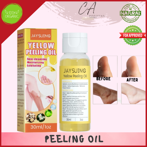 Yellow Peeling Oil 30ml Underarm Peeling Skin Peeling Body Peeling Clarity Essentials Face ...