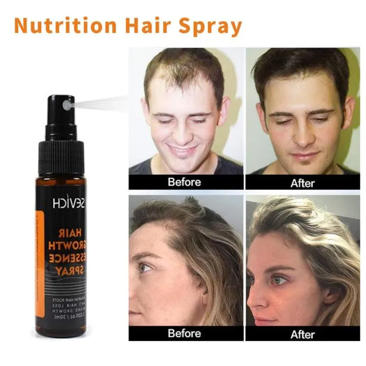 Jiay Tu【5pcs】Sevich hair growth essence spray 30ml Anti alopecia ...
