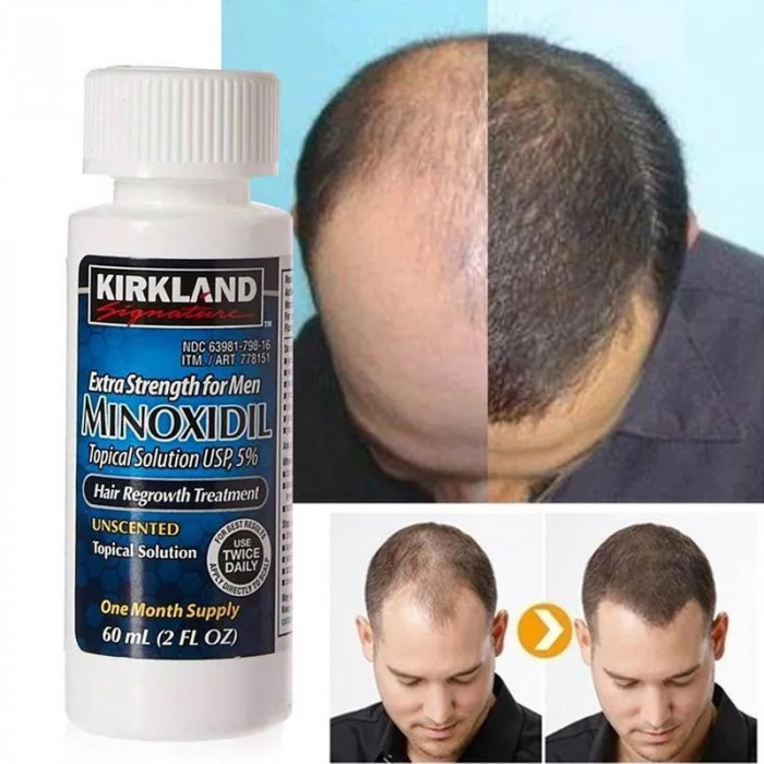 Minoxidil Hair Grower Original Minoxidil Strands 6 Hair Grower Beard