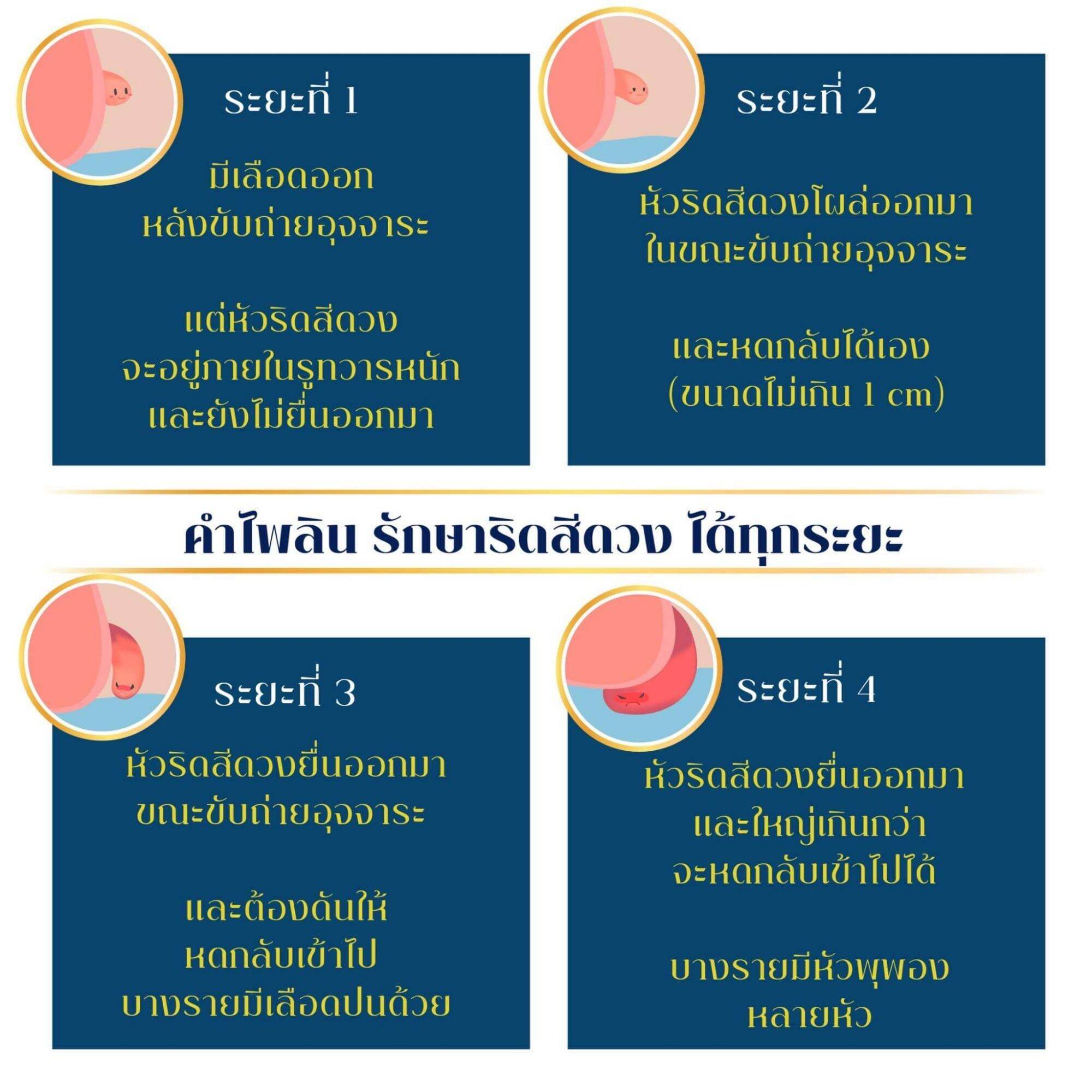 (PIMDALA) ตราคำไพลิน KHAMPAILIN ผลิตภัณฑ์ ริดสีดวง-มีเลือดออกเวลาขับถ่าย ริดสีดวงทุกระยะ ระบบ ...