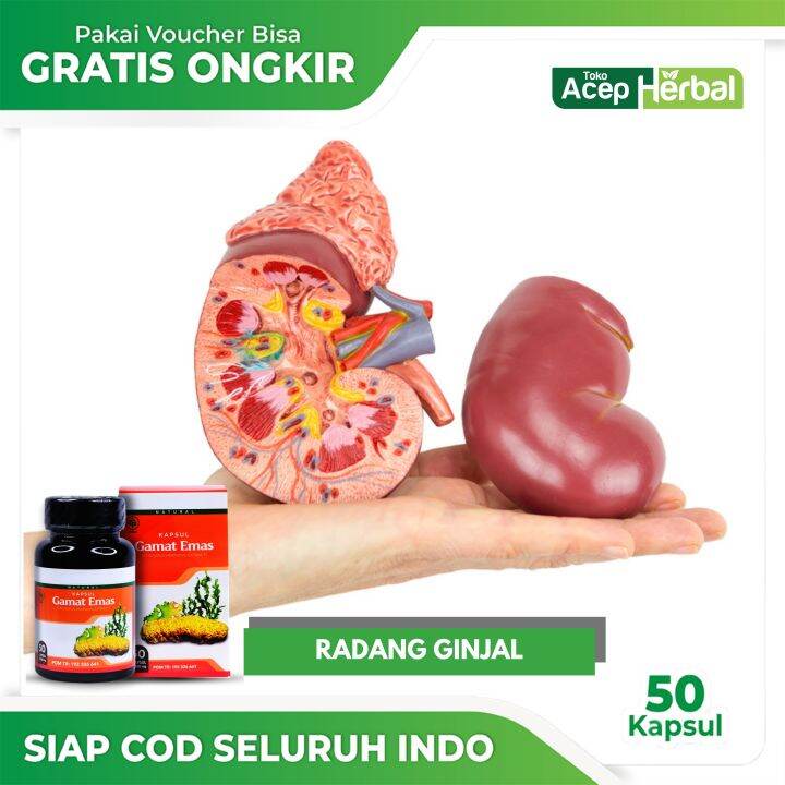 Obat Penyakit Radang Ginjal - Gamat Emas Kapsul Multikhasiat 100% ...