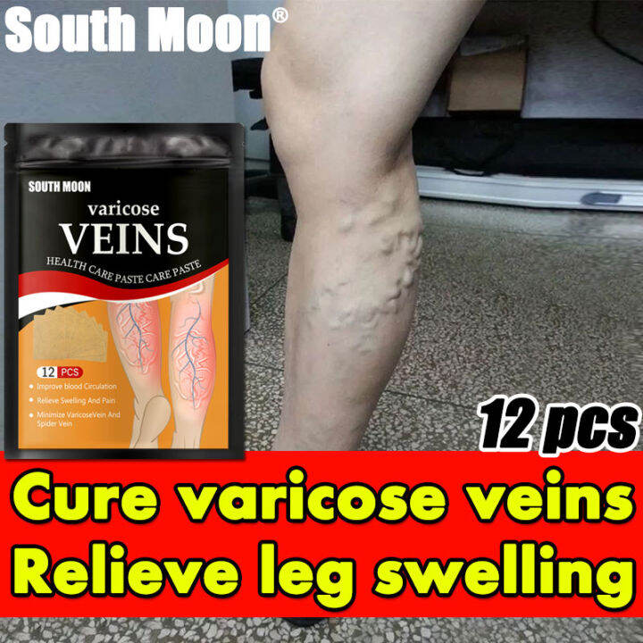 Varicose veins go away*Varicose Veins Healing Patch Promote venous ...
