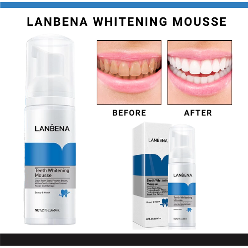 LANBENA Teeth Whitening Teeth Cleaning Mousse White Teeth Oral Hygiene ... LANBENA Teeth Whitening Teeth Cleaning Mousse White Teeth Oral Hygiene ...