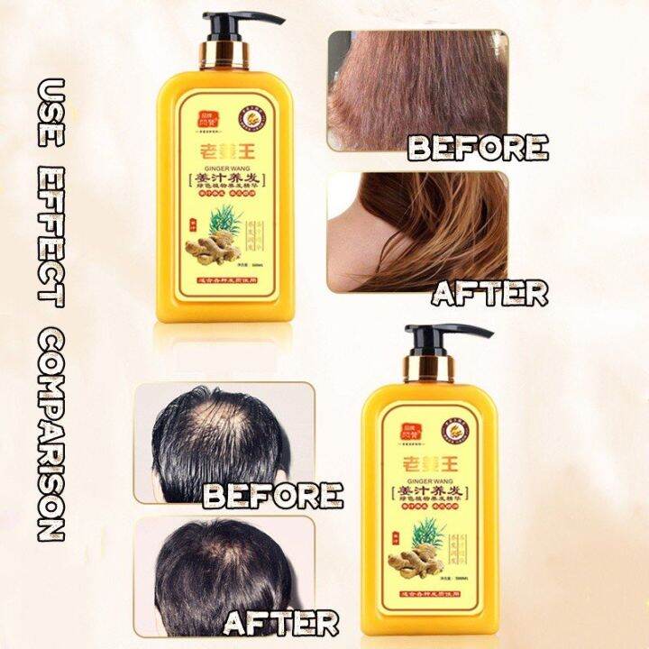 1000ML Original Natural Ginger Shampoo for Hair Loss Herbal Ginger ...