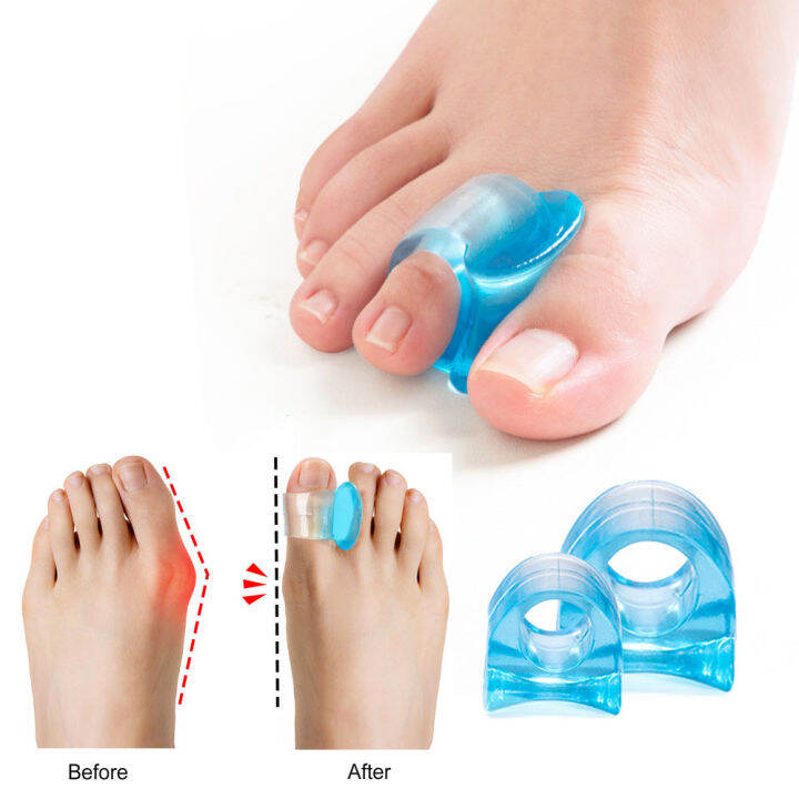 Blue Soft Silicone Toes Separator Toes Valgus Spacers Thumb Corrector ...