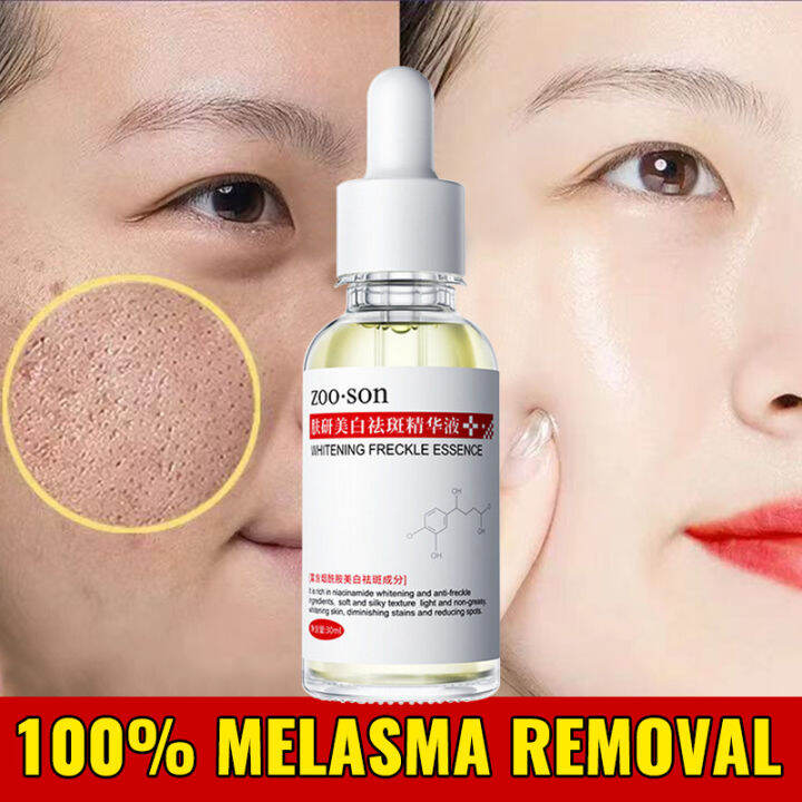Niacinamide anti melasma serum melasma remover from japan/ The United ...