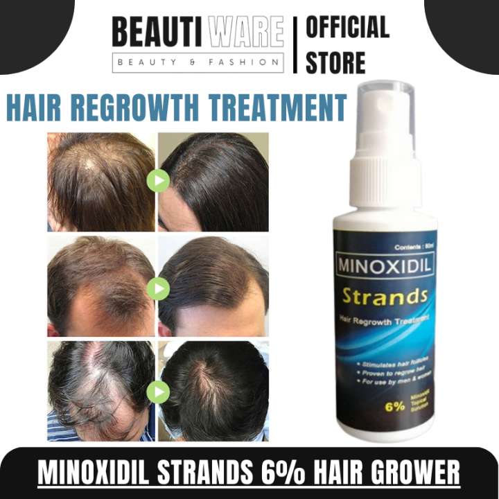 Original Minoxidil Strands 6% Minoxidil Premium Hair Grower Topical ...