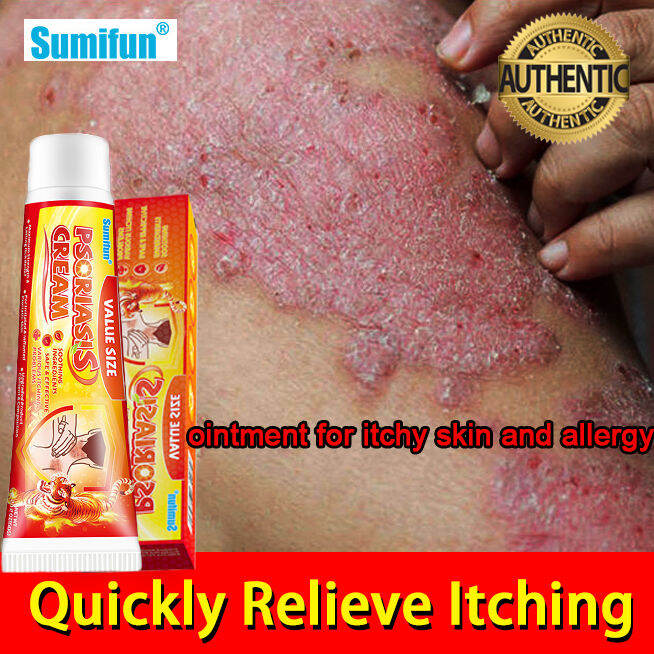 👍doctor Recommended👍sumifun Herbal Antibacterial Cream 60g Natural