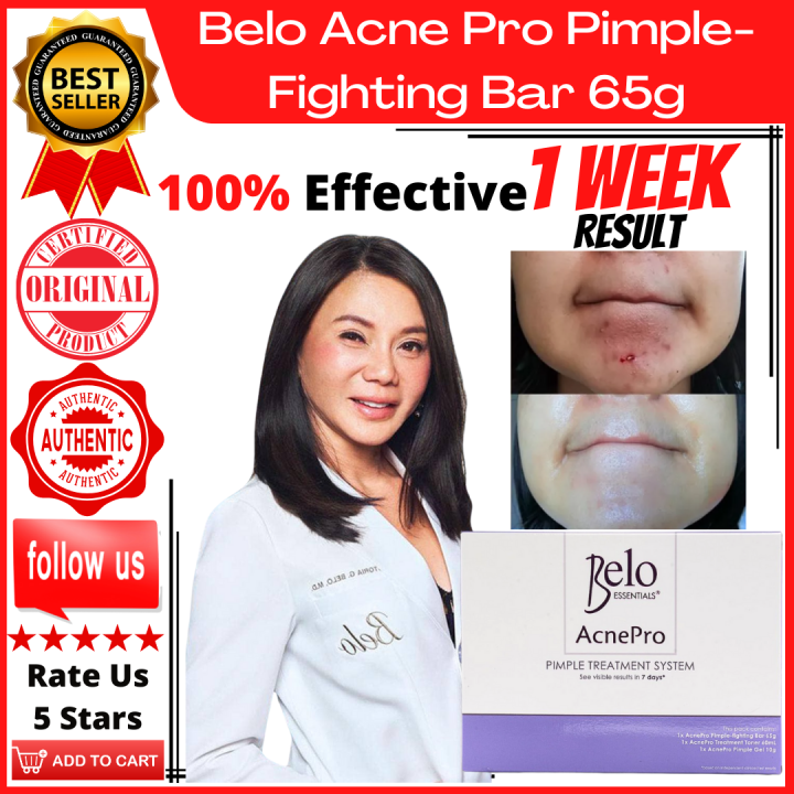 Belo Acne Pro Pimple-Fighting Bar 65g Eliminates pimples and body acne ...