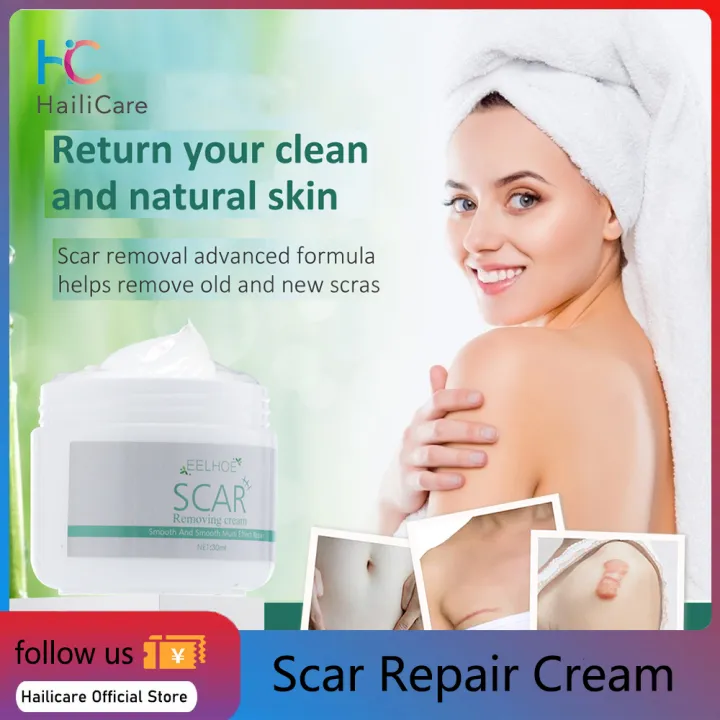 Hailicare Scar Repair Cream Scar Removal Cream Reduces Stretch Marks ...