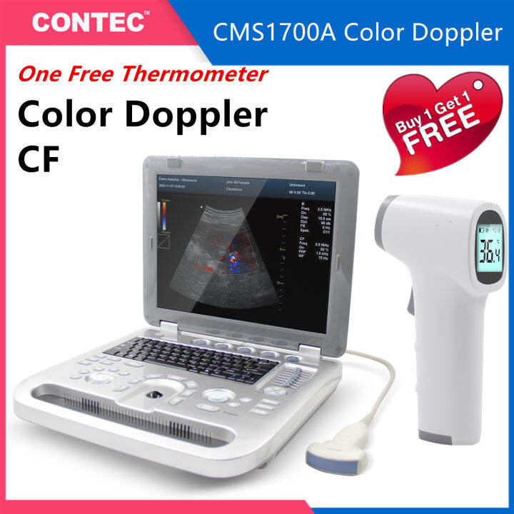 CONTEC CMS1700A Portable Ultrasound Scanner Color Doppler High ...