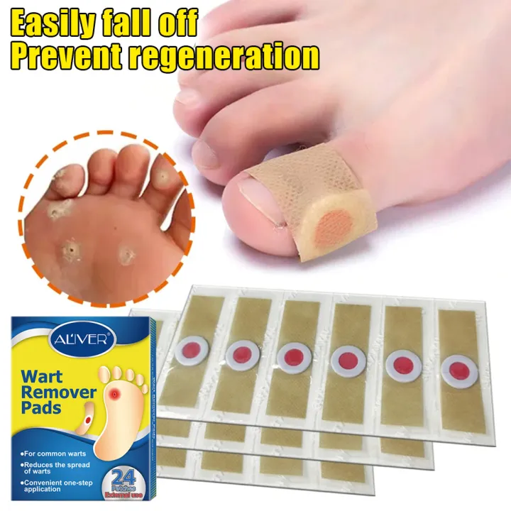 Local delivery Feet Corns Warts Removal Patch Feet Care Tool Foot Patch ...