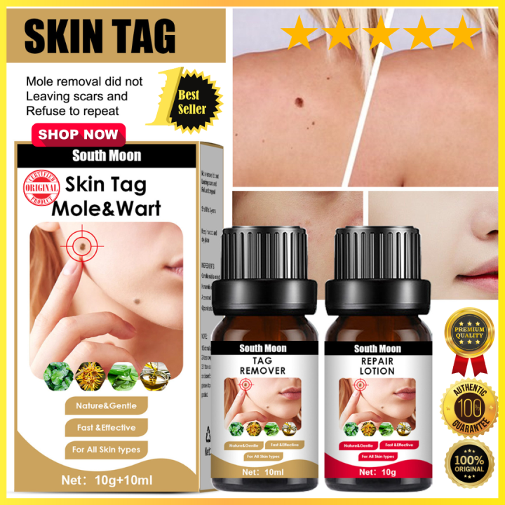 South Moon Skin Tag Removal Nevus Removal Suit Spotting Nevus Cream ...