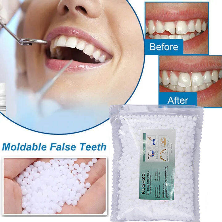 【Fast filling】DIY Tooth Repair Kit Temporary Tooth Repair kit ...