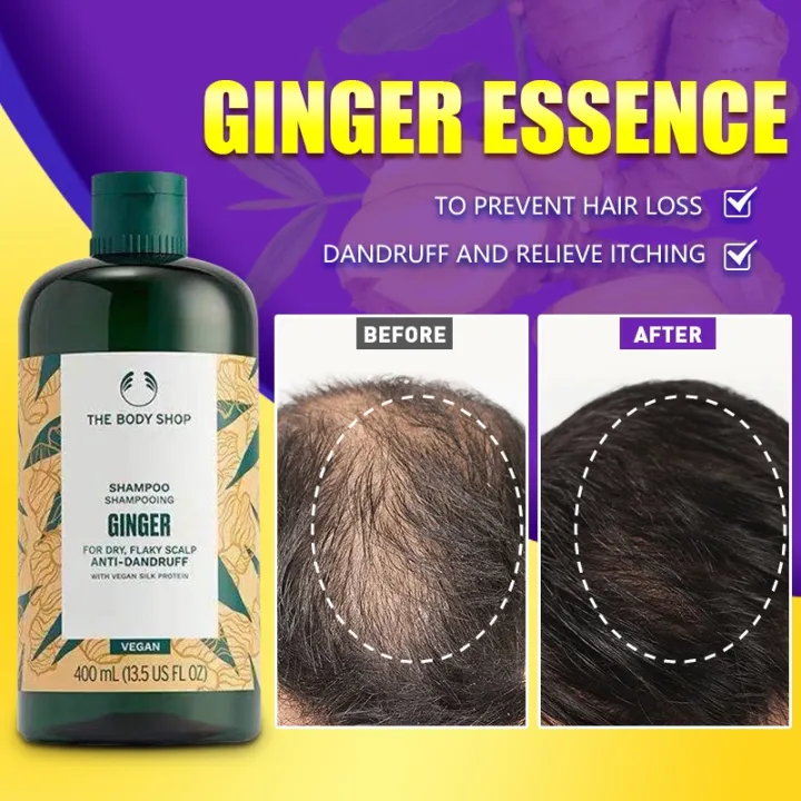 The Body Shop Ginger 400ml Anti-Dandruff Shampoo ginger Hair Loss Baldness hair care growth ...