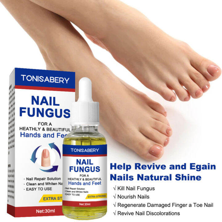 Nail Fungal Treatment Serum Set Anti Infection Paronychia Onychomycosis ...