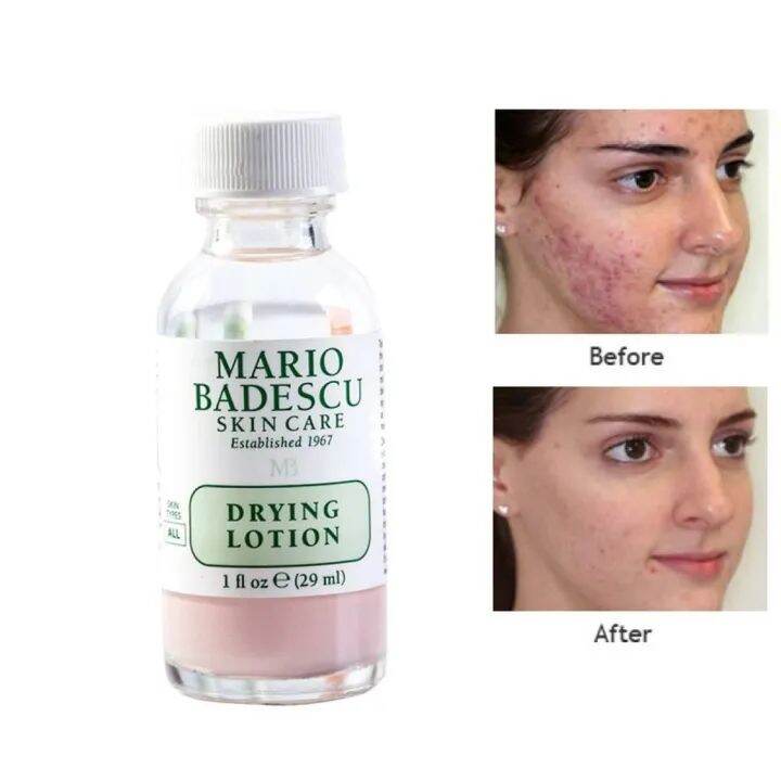 Mario Badescu Drying Lotion 29ml [Acne] [Blemish][Spot Solution ...