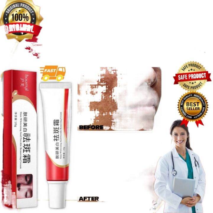 Pekas Remover Effective Melasma Cream Anti Freckle Collagen Original ...