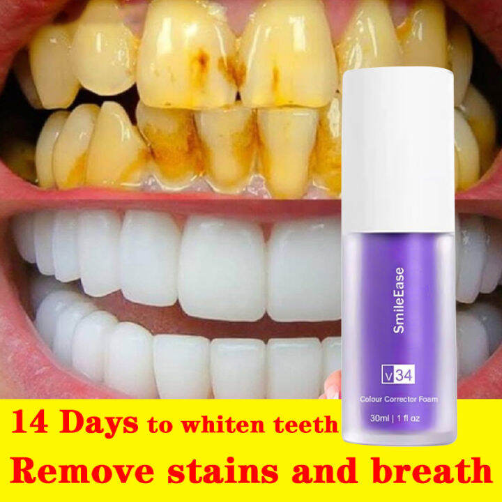 Smile Ease Toothpaste V34 teeth whitening color corrector teeth colour ...
