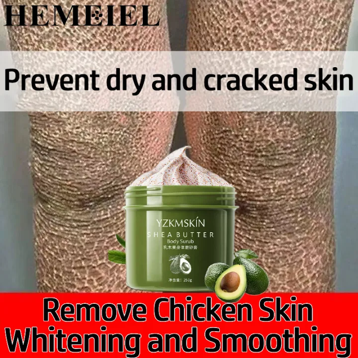 Soap Whitening Effective Body/Chicken Skin Remover/Gentle Exfoliator ...