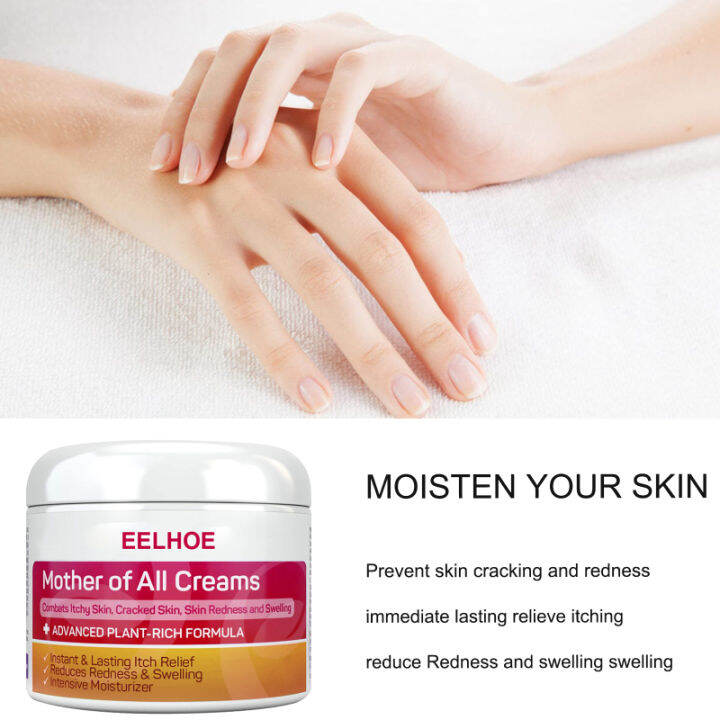 EELHOE Skin Psoriasis Cream Dermatitis Eczematoid Eczema Ointment ...
