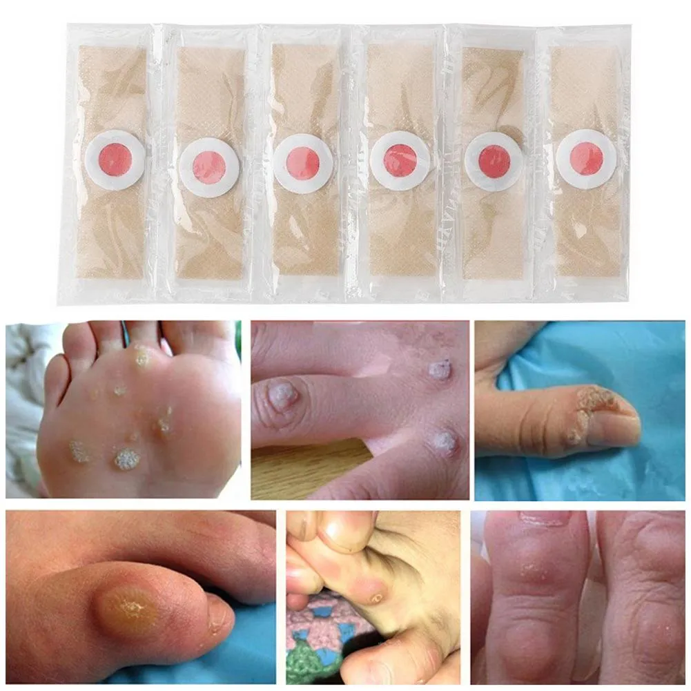 Foot Makeup For Corns | Saubhaya Makeup