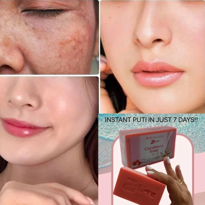 NO NEED DERMA TRENDING NA SABON NA PAMPAKINIS AT PAMPAPUTI IN JUST 1-2 WEEKS LANG! ZAFYRE ...