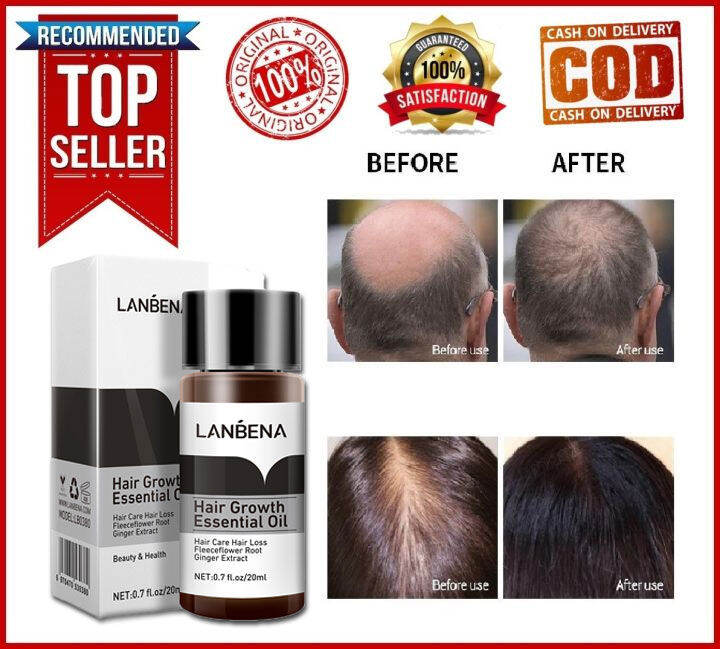 Lanbena Hair Growth Essential Oil 20ml Hair Loss Treatment Prevent