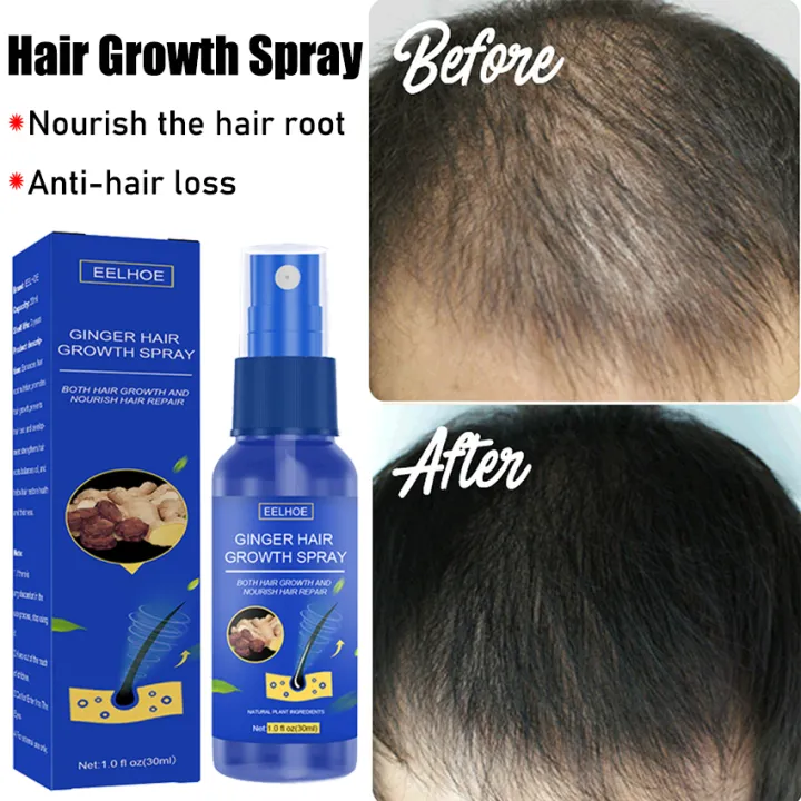 Hair Growth Spray Fast Grow Hair Loss Preventing Hair Loss Care Dense ...