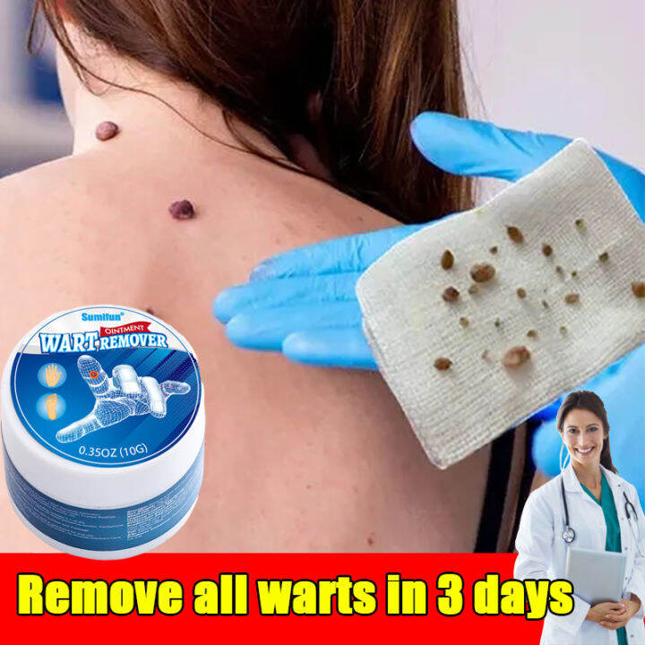 Original Warts Remover Cream Warts Magic Remover Wartz Removal Cream ...