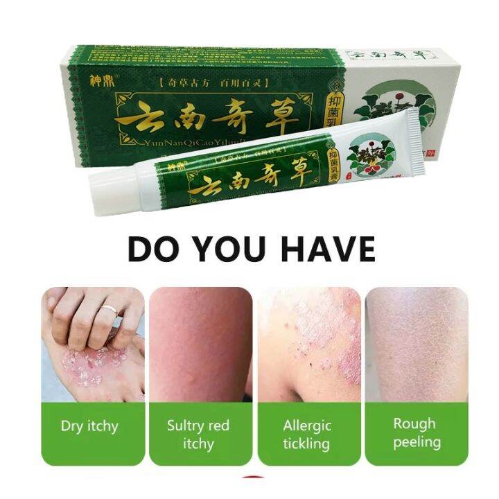17g Chinas Secret Recipe Psoriasis Ointment Dermatitis Eczematoid
