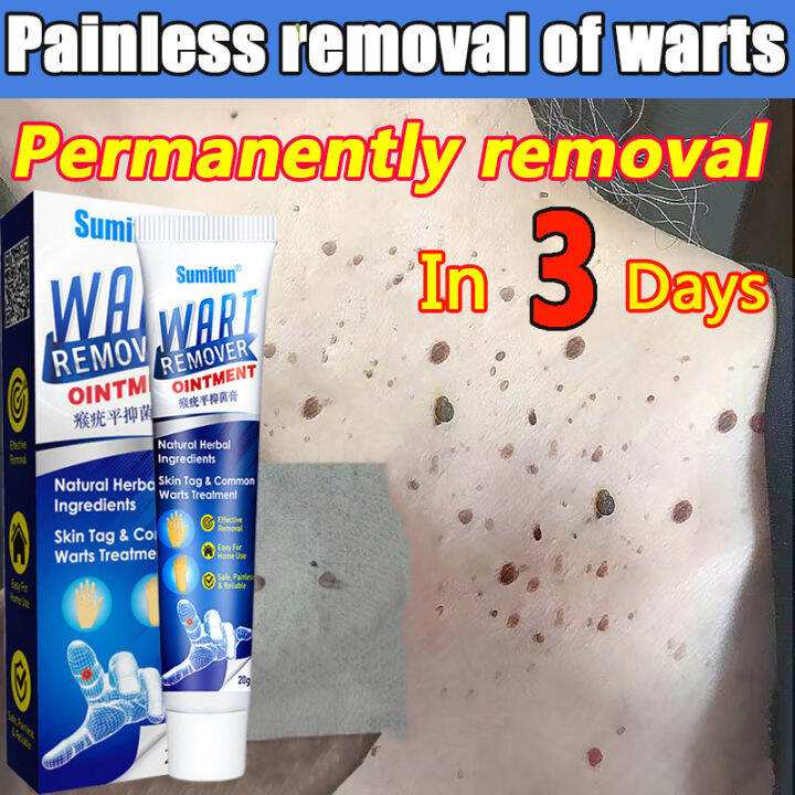 SUMIFUN Warts Remover Cream Original 20g Warts Magic Remover Wartz ...