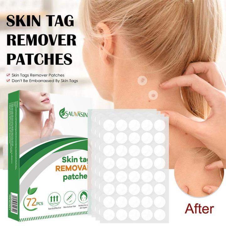HOLD LIVE 72PCS Skin Tag Remover Patch 2 Sheets Acne Removal Patches ...
