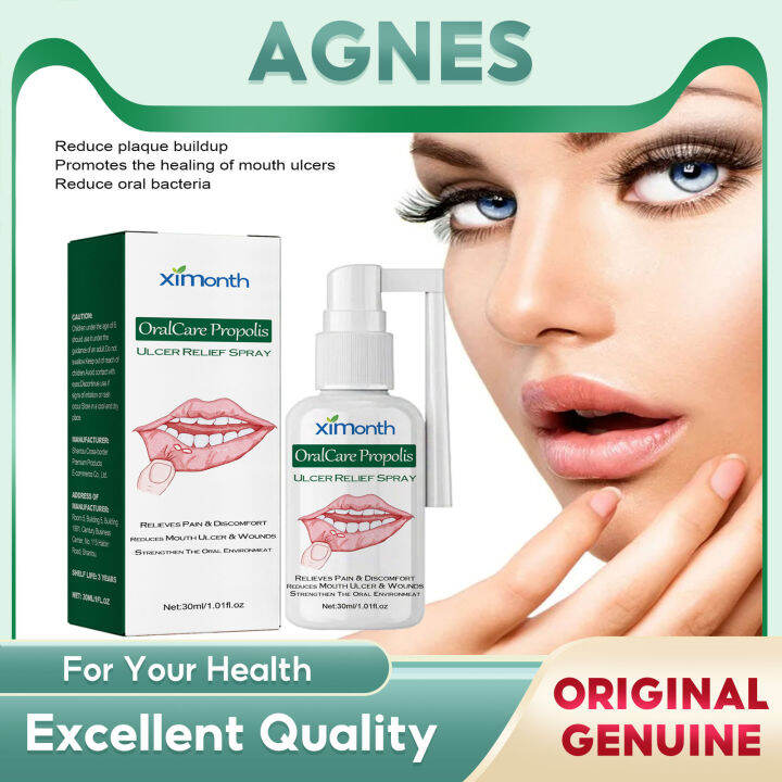 Ximonth Mouth Clean Oral Treatments Of Oral Ulcer Pharyngitis Halitosis ...