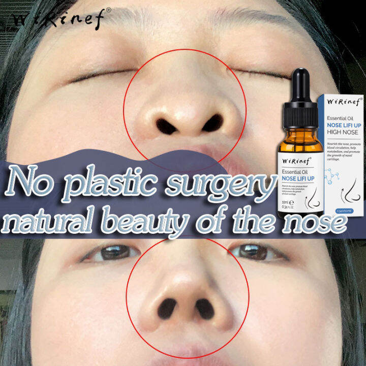 Say Goodbye to Flat Nose! WiRinef Beauty Nose Essential Oil Shape the ...
